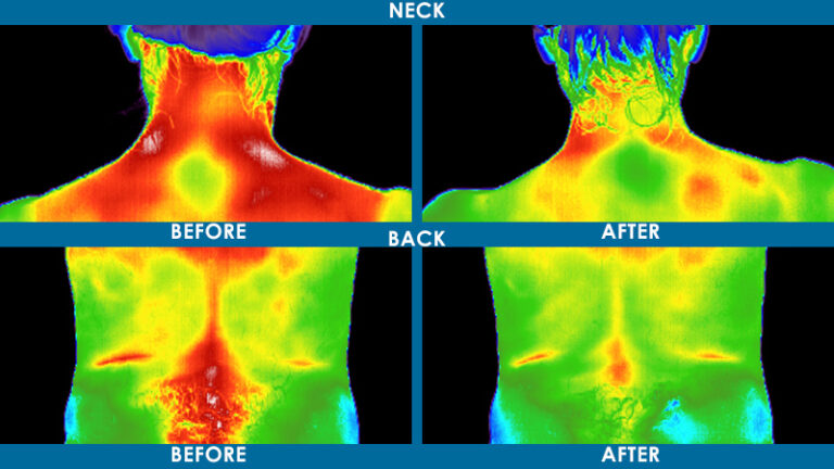 Equiscope Therapy in Newport Beach, CA | O2 Health Lab